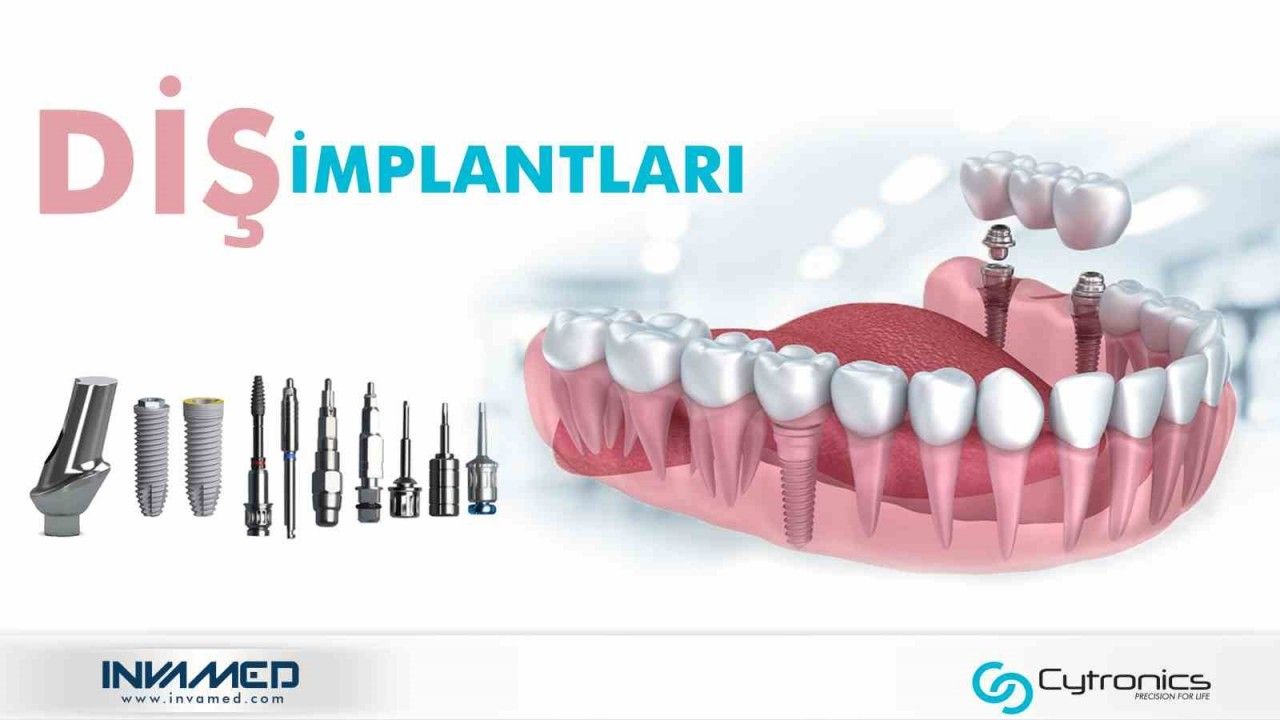 Türkiye’nin dünya çapında tanıttığı yenilik: INVAMED diş implantları ...